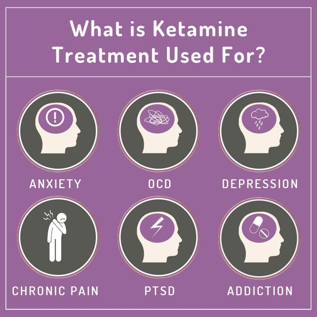 What Is Ketamine Treatment Therapy? A Scientific Guide