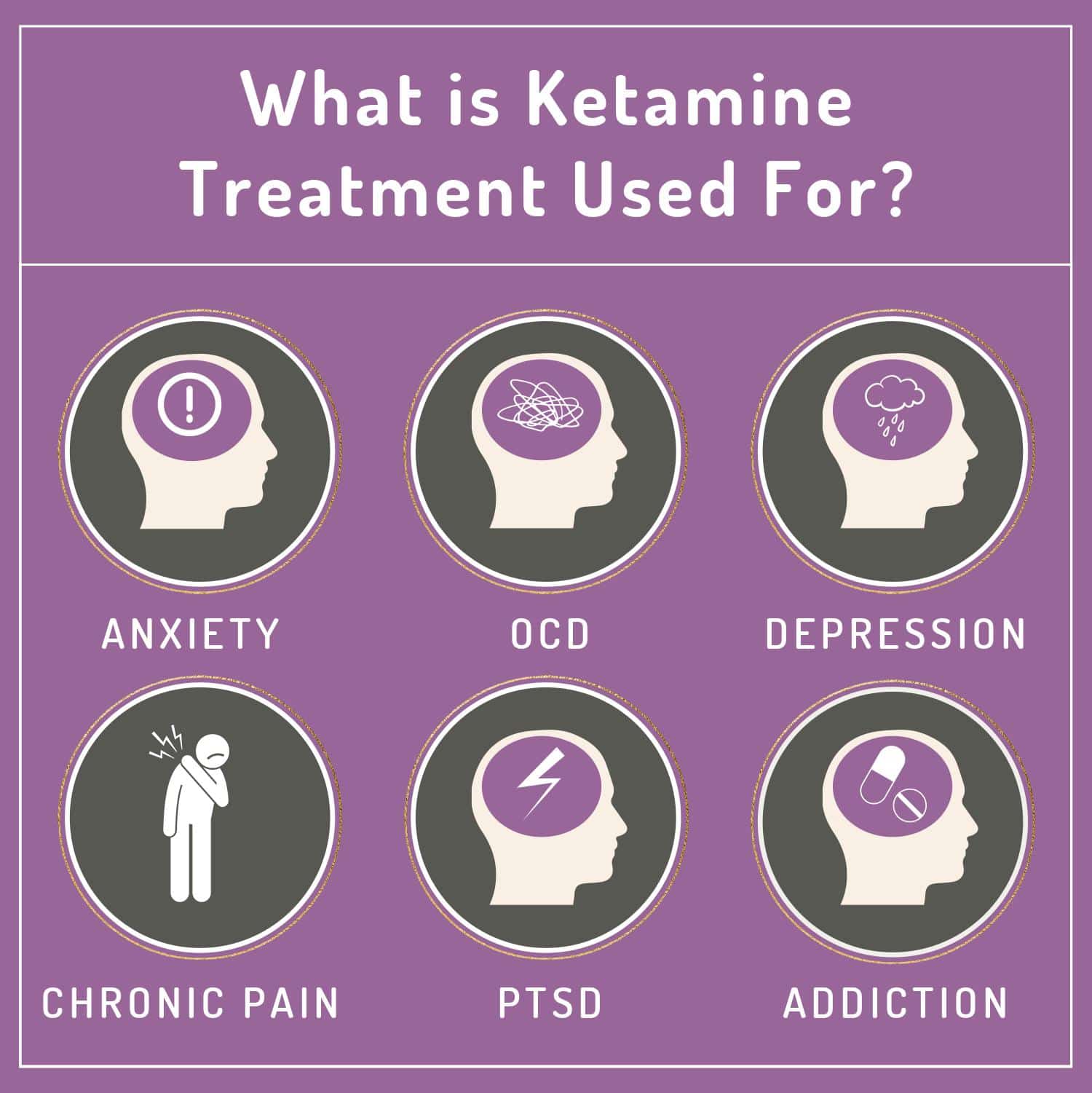 What Is Ketamine Treatment Therapy? A Scientific Guide